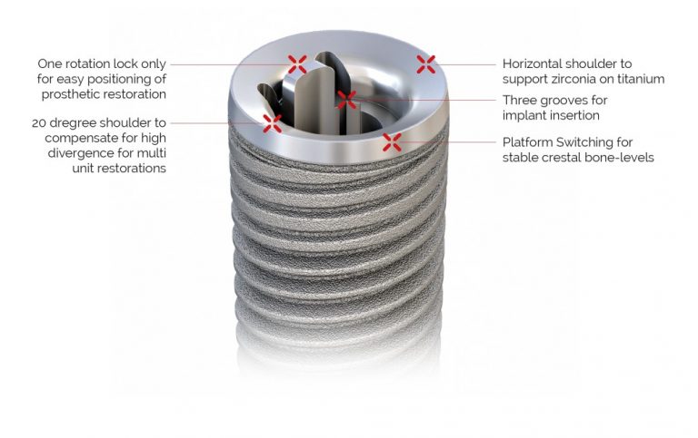 Matrix Digital Implant - Adm1stchoicemedicals
