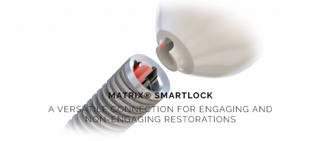 Matrix Digital Implant - Adm1stchoicemedicals