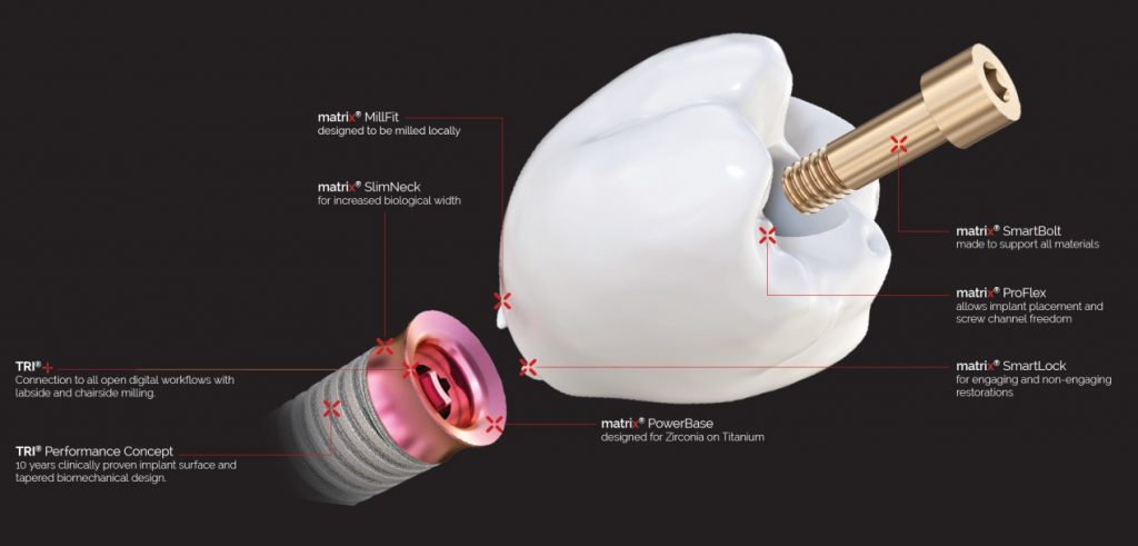 Matrix Digital Implant - Adm1stchoicemedicals
