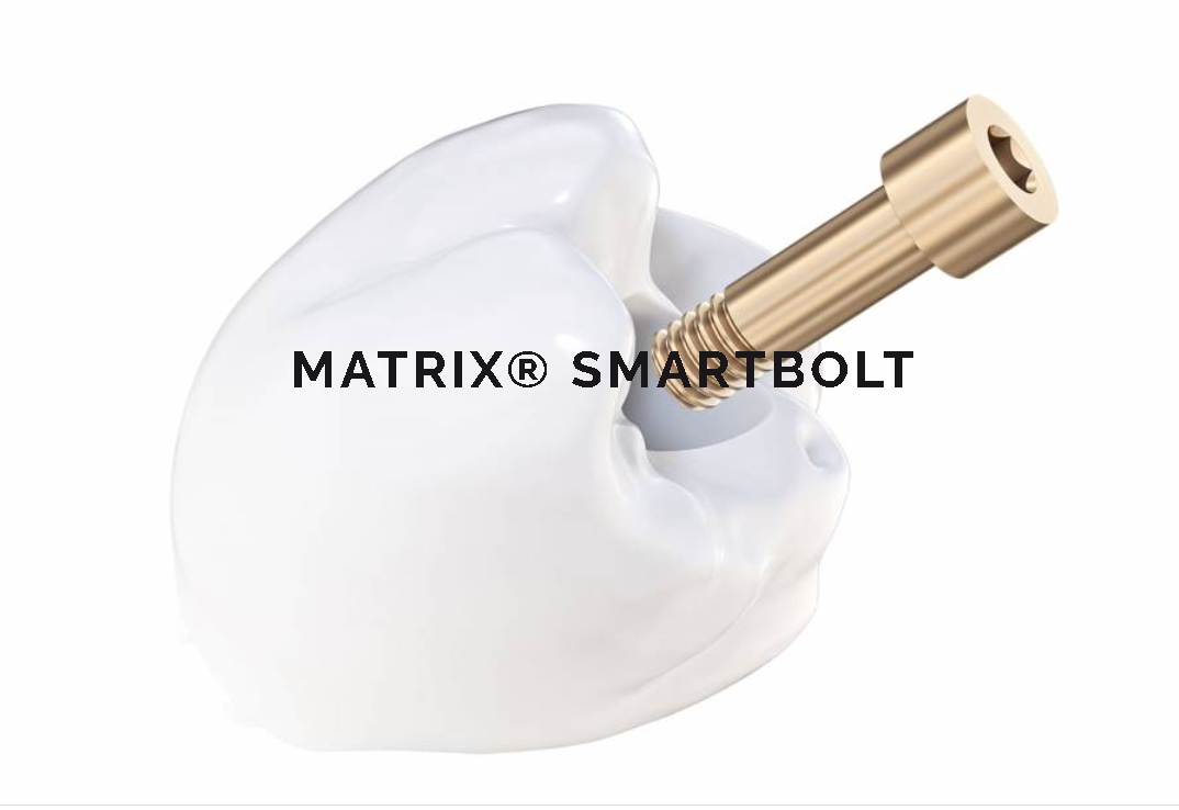 Matrix Digital Implant - Adm1stchoicemedicals